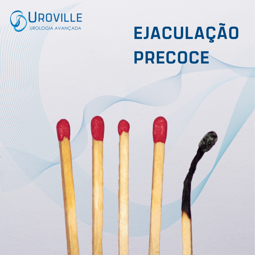 Ejaculação precoce: causas e tratamentos | Uroville | Urologia avançada